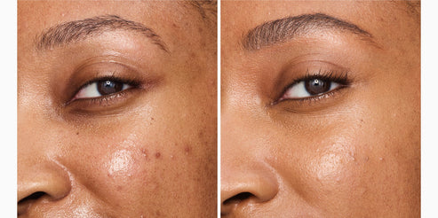 concealer before after