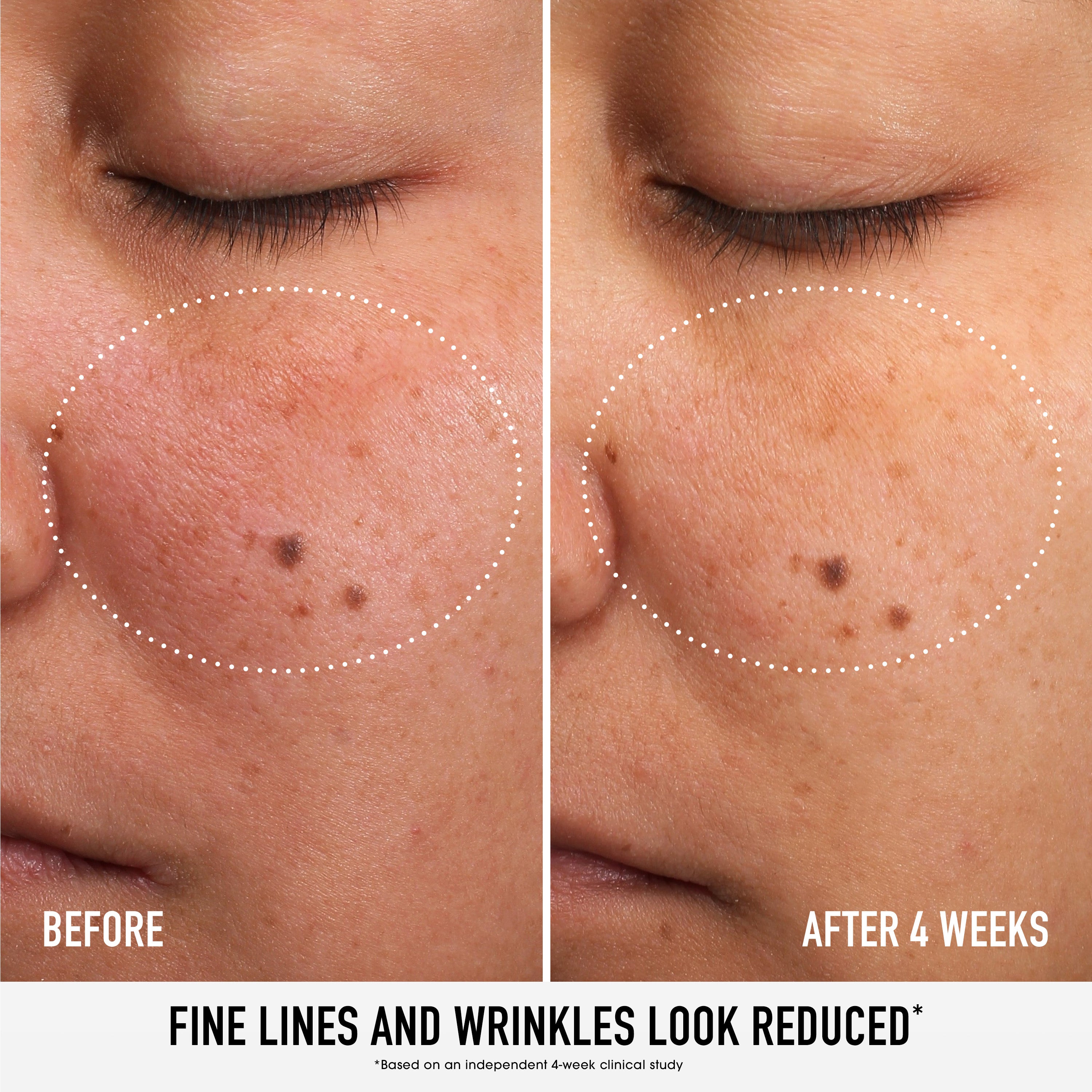 Pure Smooth | Serum for Textured Skin | Anti Wrinkle Serum